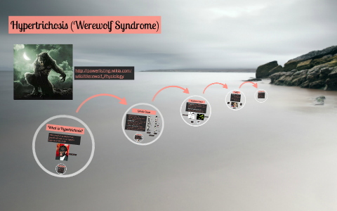 Hypertrichosis (Werewolf Syndrome) by Nick Grams on Prezi