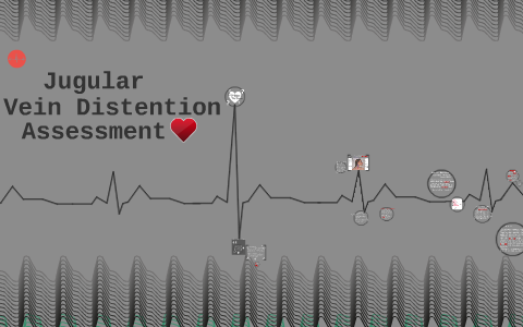 Jugular Vein Distention Assessment by Dakota wangler on Prezi