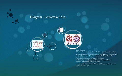 Diagram of the Body System : Leukemia by Hazel Taytayan on Prezi