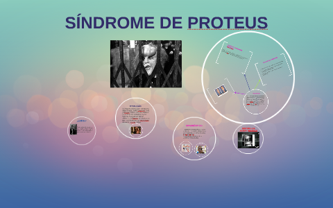 SÍNDROME DE PROTEUS by María José Quilumba Maldonado on Prezi