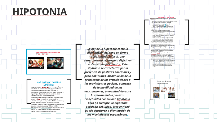 HIPOTONIA by luz johana torres saldaña on Prezi