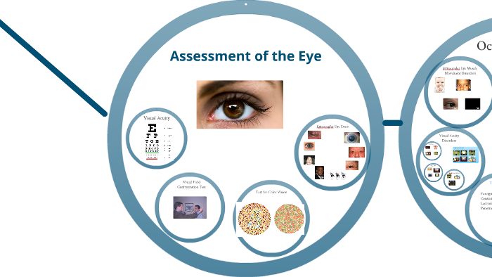 N1 - Visual Alterations by Sarah Fry on Prezi