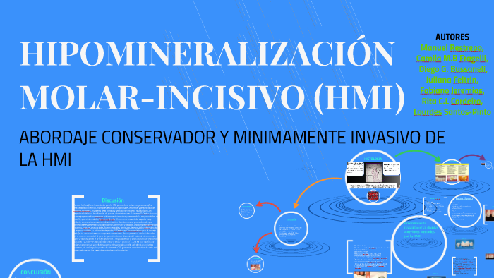 HIPOMINERALIZACIÓN MOLAR-INCISIVO (HMI) by anii santiiago on Prezi