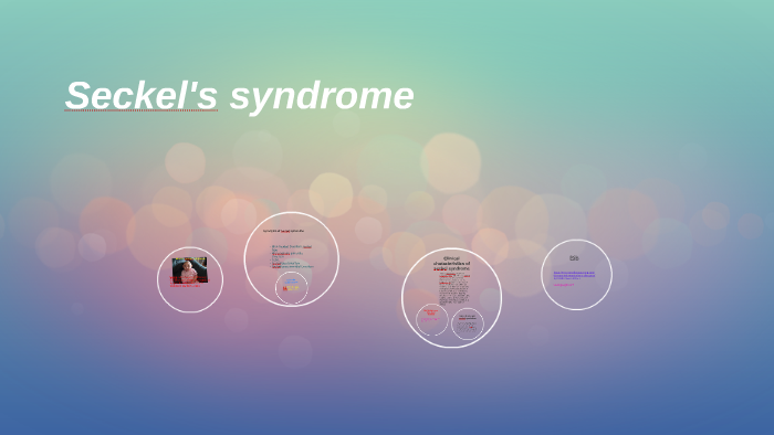 Seckel's syndrome by dylan nelka on Prezi