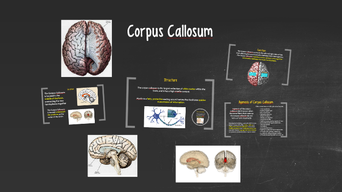 Corpus Callosum by David Hom on Prezi