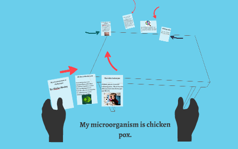 My microorganism is: chicken pox by skylar mosley on Prezi