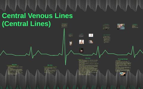 Central Lines by on Prezi