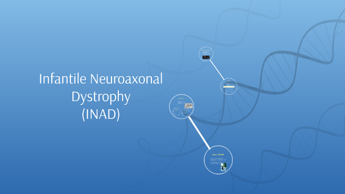 Infantile Neuroaxonal Dystrophy by Kristina Feddersen on Prezi