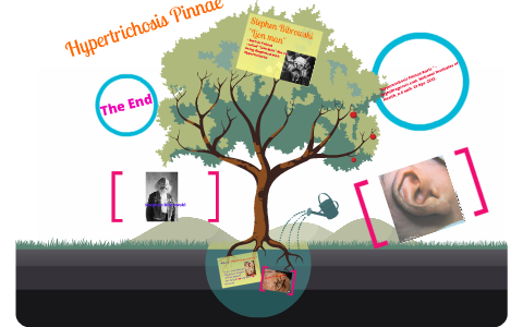 Hypertrichosis Pinnae by olivia jeans on Prezi