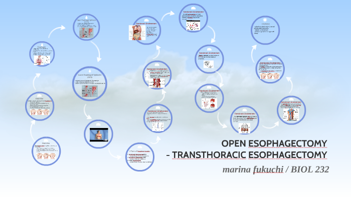 Open Esophagectomy by Marina Fukuchi on Prezi