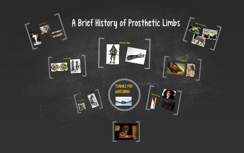 A brief history of prosthetic limbs by Juniper Wolf on Prezi