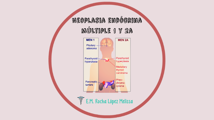 NEM 1 y 2A by Mel Rocha on Prezi