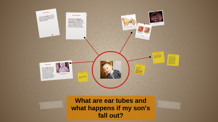 What are ear tubes and what happens when they fall out? by Kelly Mason ...