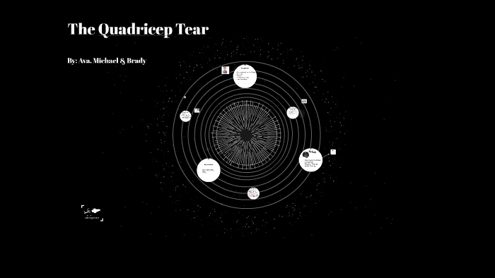 The Quadricep Tear by Ava Geiger on Prezi