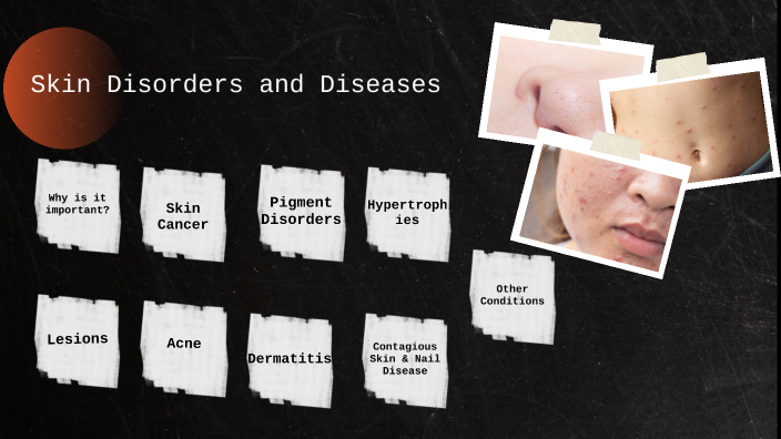 Fundamentals Chapter 4: Disorders and Diseases of The Skin by Amanda ...