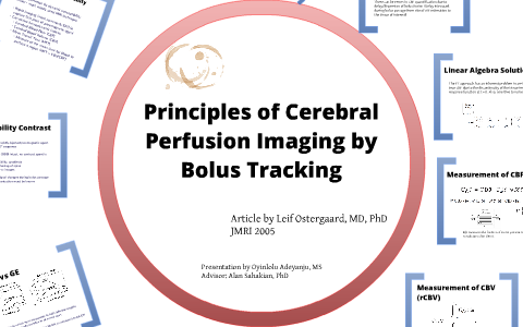 Principles of Cerebral Perfusion Imaging with Bolus Tracking by ...