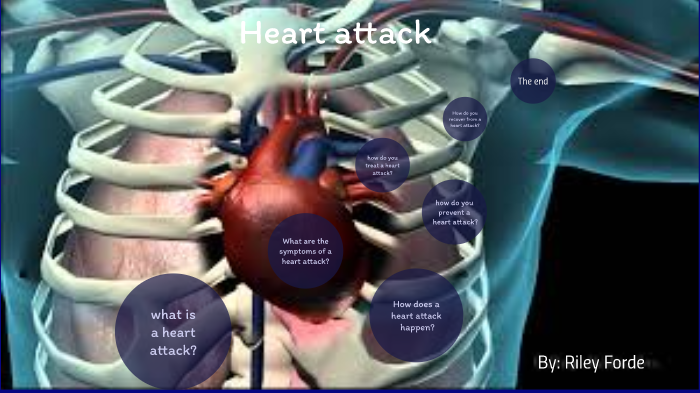 heart attack presentation completed by Riley Forde on Prezi
