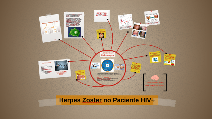 Herpes Zoster no Paciente HIV+ by Camila Alves on Prezi
