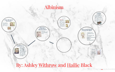 Albinism by Ashley Withrow on Prezi
