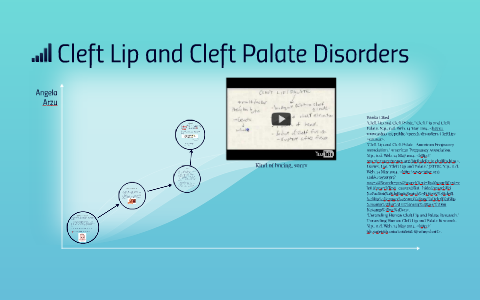 Cleft Lip and Cleft Palate Disorder by Angela Arzu on Prezi