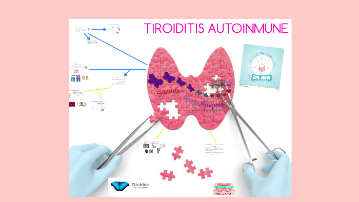 TIROIDITIS AUTOINMUNE by Marta Galán Donoso on Prezi