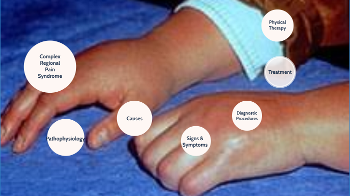 crps by Ayesah Martin on Prezi