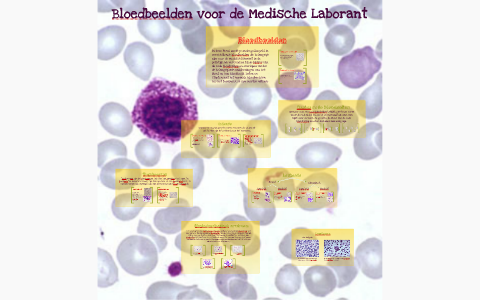 De belangrijkste bloedbeelden by Isabelle Rits on Prezi