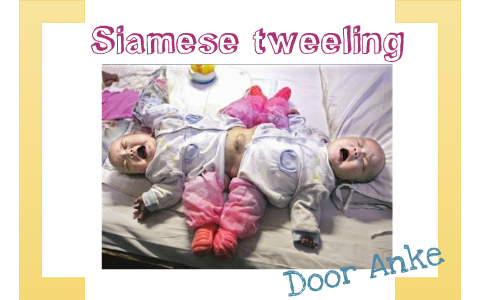 Siamese tweeling by Anke Geerts on Prezi