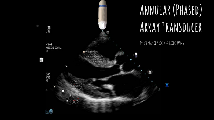 Annular Transducer by Heidi Wang on Prezi
