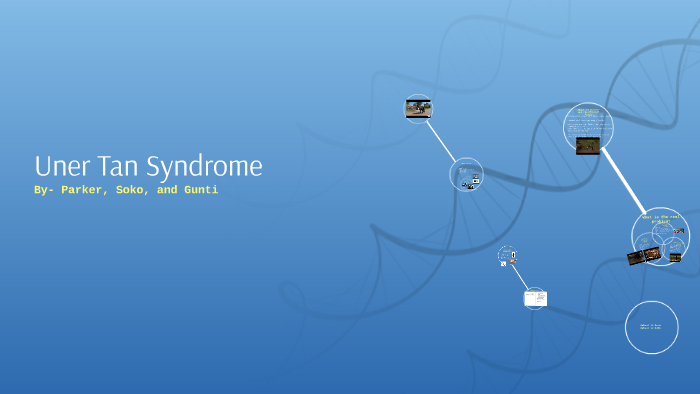 Uner Tan Syndrome by Luke Soko on Prezi