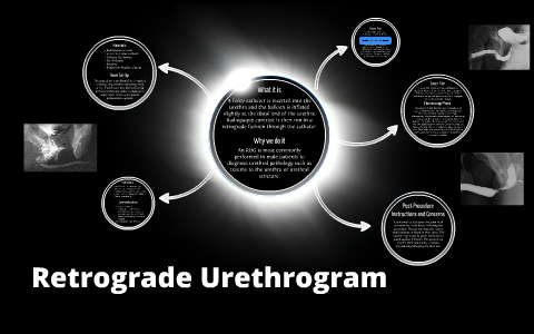 Retrograde Urethrogram by Dirk Knisely on Prezi