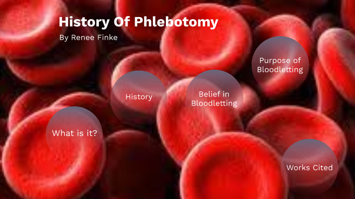 History of Phlebotomy by RENEE FINKE on Prezi