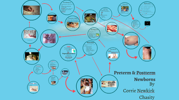 Preterm & Postterm Newborns by Kuljit K on Prezi