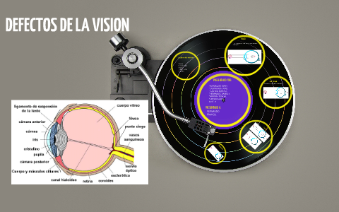 DEFECTOS DE LA VISION by Daniela Hernandez on Prezi