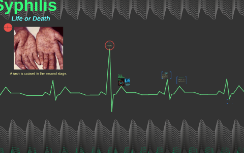 Syphilis by Rachel Byrum on Prezi