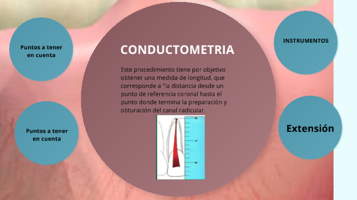 conductometria by juan haro on Prezi