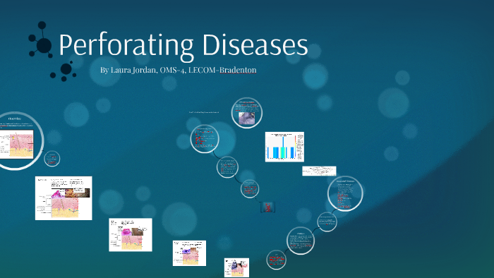 Perforating Diseases by Laura Jordan on Prezi