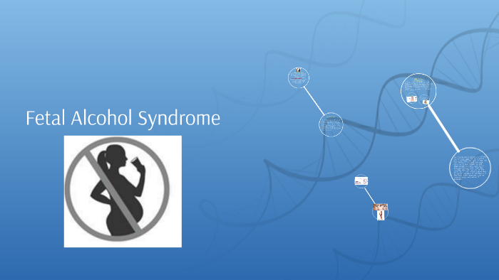 Fetal Alcohol Syndrom by Maren Fuqua on Prezi