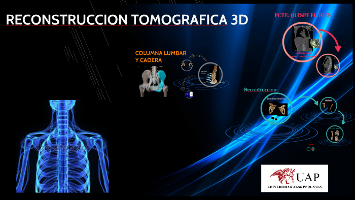 RECONSTRUCCION MPR Y VR by cristian neyra on Prezi