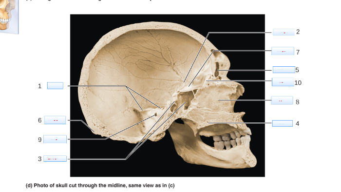 Petrous part of temporal bone by Anastasia Sweet on Prezi