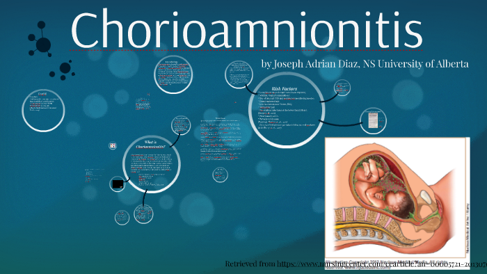 Chorioamnionitis