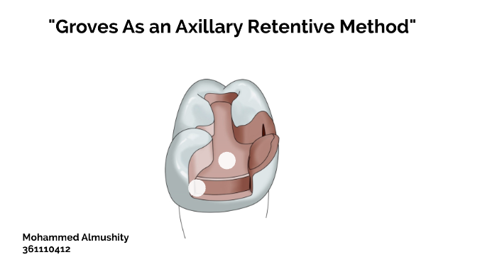 Groves as an axillary retentive method by Mohammed Almushity on Prezi