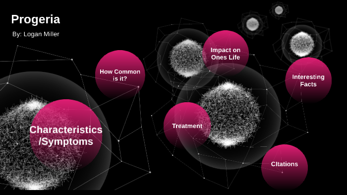 Uner Tan Syndrome by Logan Miller on Prezi