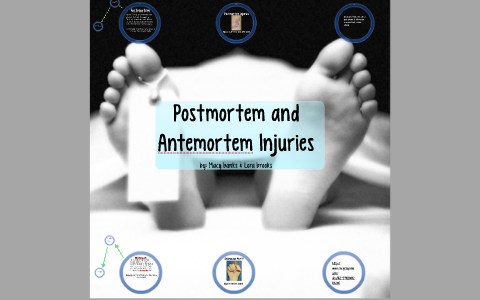 Postmortem & Antemortem injuries by lora brooks on Prezi