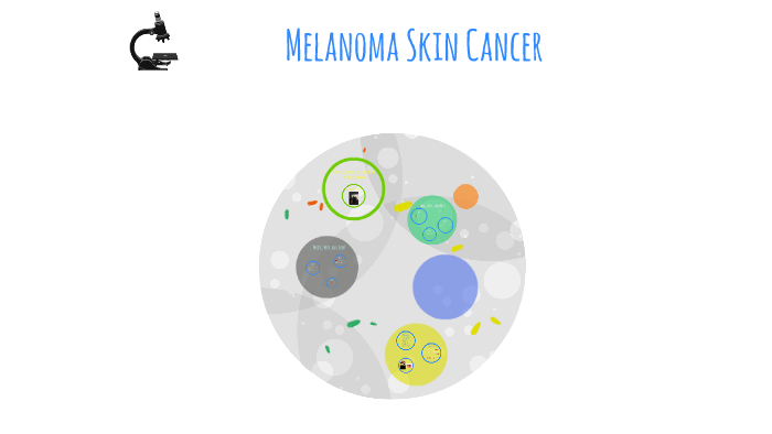 Melanoma Skin Cancer by Ashley Crites