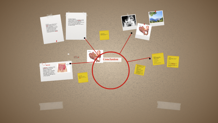 A volvulus is a twisting of the intestine that can occur in by on Prezi
