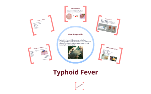 Typhoid Project by keon osborne on Prezi