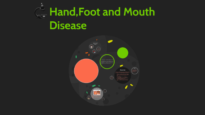 Hand,Foot and Mouth Disease by kristina richards on Prezi