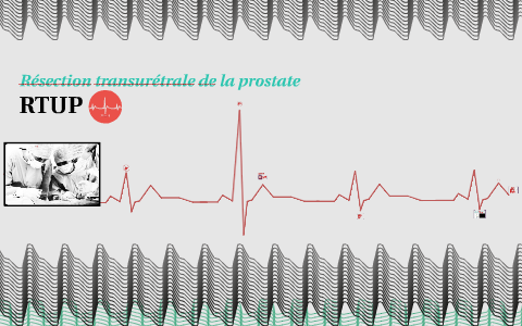 RTUP by Chantal McManus on Prezi