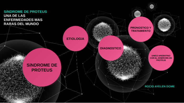 SINDROME DE PROTEUS by rocio dome on Prezi